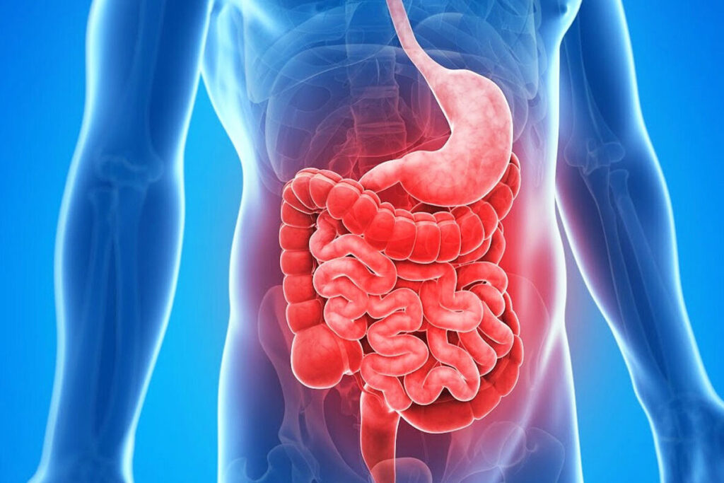 Spastik Kolit Nedir? - Doç. Dr. Murat Kanlıöz